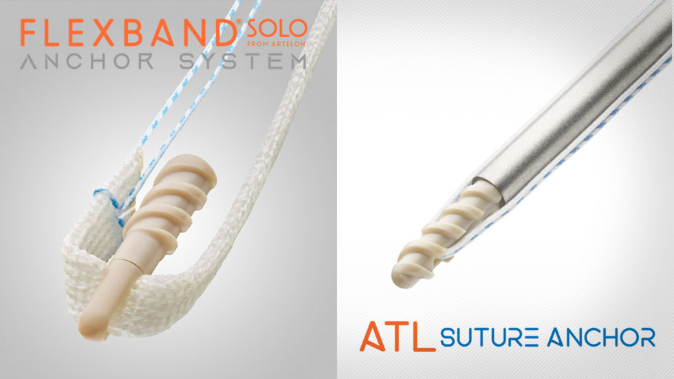 Artelon Expands Ankle Stability Line | OR Today