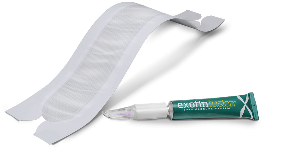 Exofin Fusion Redesign Receives FDA Approval | OR Today