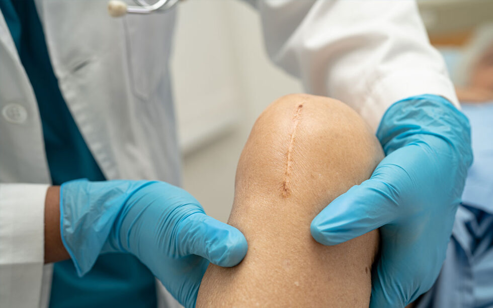 Performing Total Joint Surgeries Outpatient in ASCs | OR Today