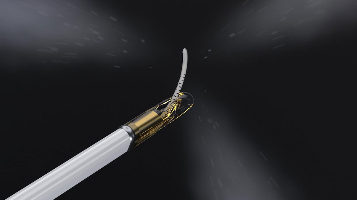 Urologist Performs Prostate Tissue Ablation with Vanquish Water Vapor ...